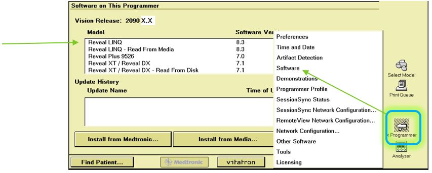 Reveal LINQ with TruRhythm - Brady & Pause Detections Disabled ...